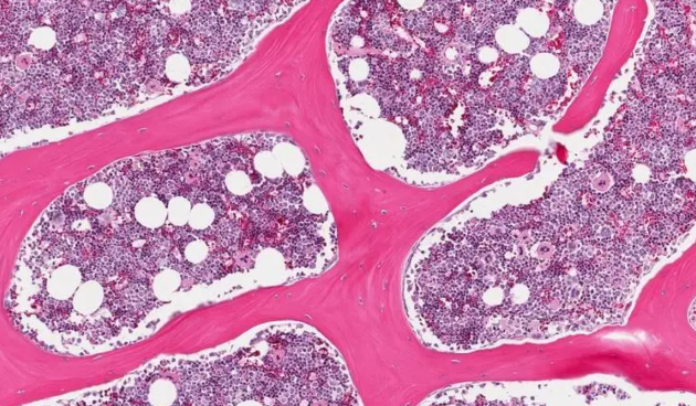 Mayo Clinic celebra la realización de 10 000 trasplantes de sangre y ...